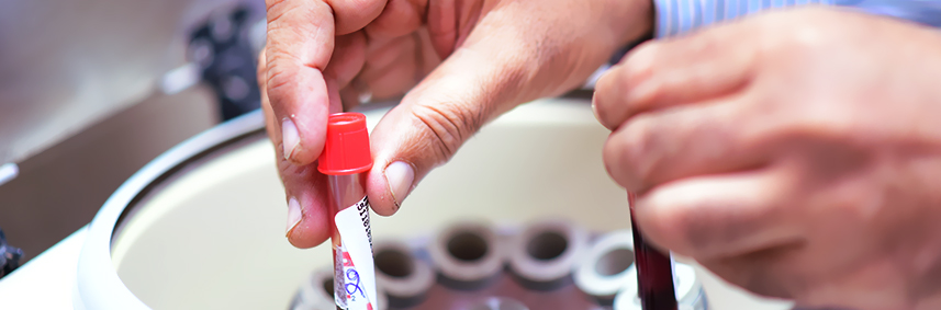 Anti-Coagulation Clinic | National Institute of Cardiovascular Diseases ...